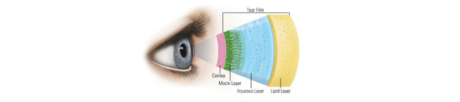 Copy of Dry Eye Header (1) - Optix Eye Care